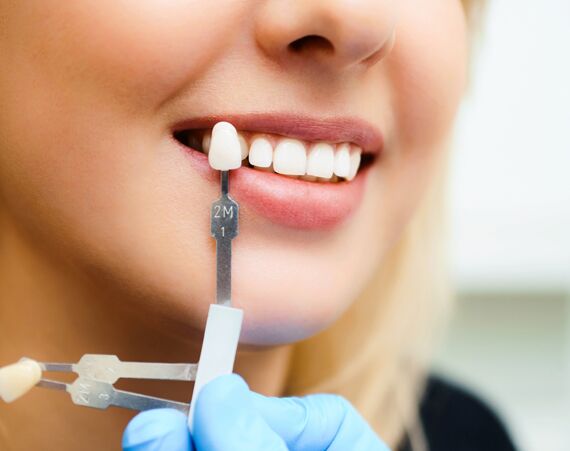 Cosmetic Dentistry in Gillingham, Faversham, Minster & Sittingbourne